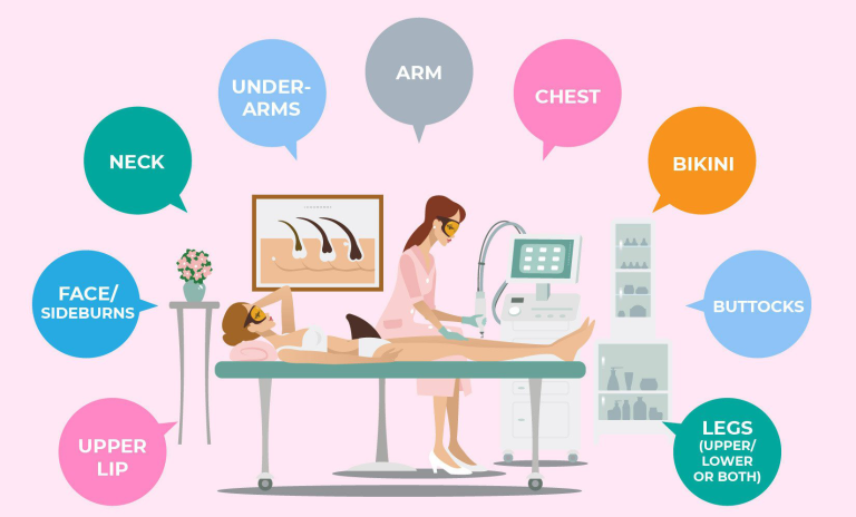 Laser hair Removal Popular Treatment Areas: Face, Body & More ...