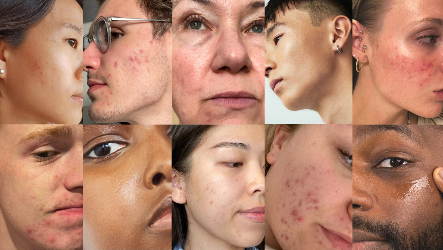 #1 New & Safe | Skin Conditions and Treatments Guide - Clinique Médico ...